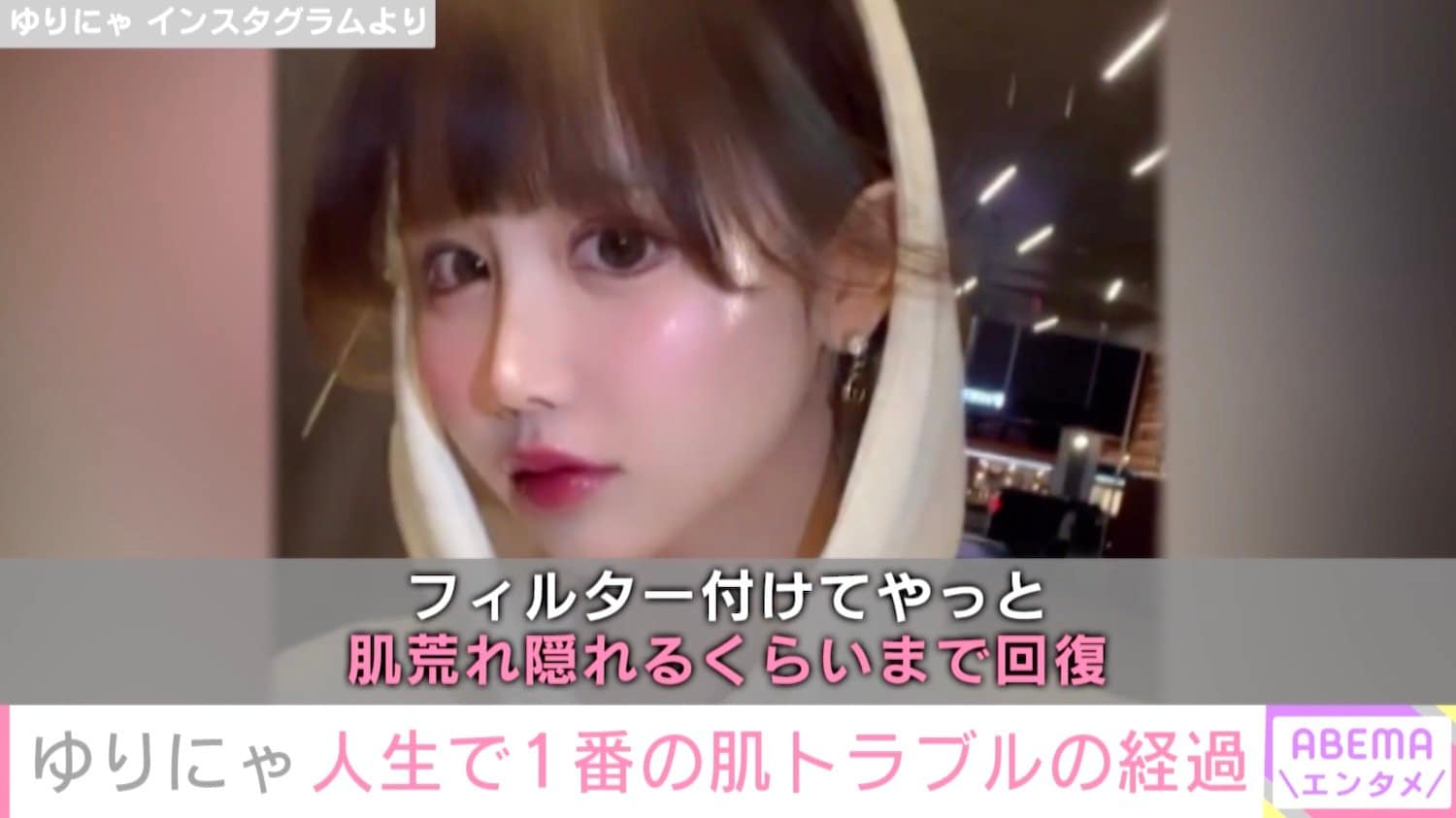 体重39.5kgの人気インフルエンサーゆりにゃ、「もう外には決して、歩けない」人生で1番の肌トラブルの経過を報告 | エンタメ総合 ...