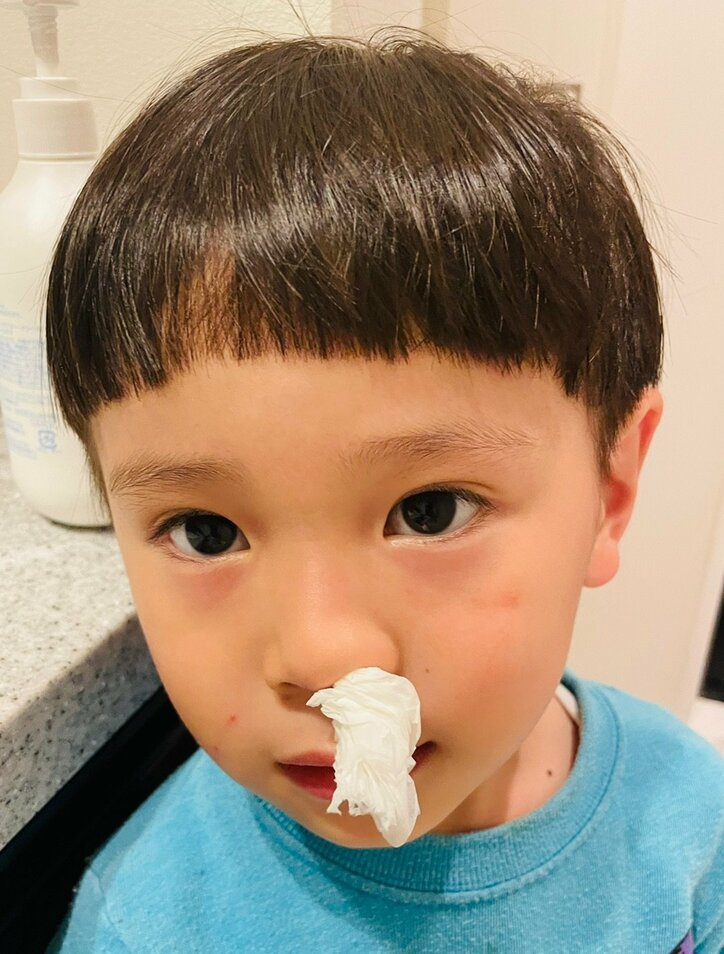 ココリコ・遠藤の妻、心配になる子ども達の症状「深刻になってしまう」 話題 Abema Times