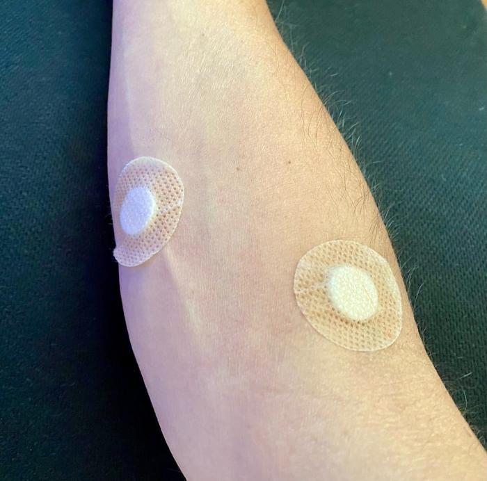 【写真・画像】桑野信義、直腸がん手術後に転移があるか確認するために受けた検査「何回採血やら薬を入れたか」 1枚目 | 話題 | ABEMA TIMES | アベマタイムズ