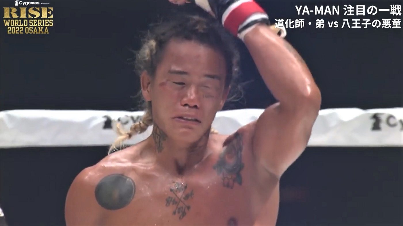 OFGマッチ、不運のアクシデントでドクターストップ 悔し涙の勝者に「いい試合だった」「視力に影響なければ」称賛と心配の声 | ニュース ...