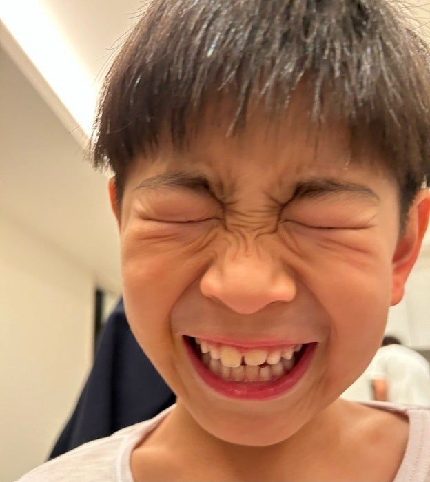 ココリコ・遠藤の妻、全身麻酔で手術をすることになった自身の症状「声が出ないわけだ。。。」 話題 Abema Times アベマタイムズ